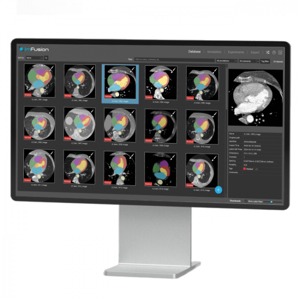 ImFusion Labels - ImFusion