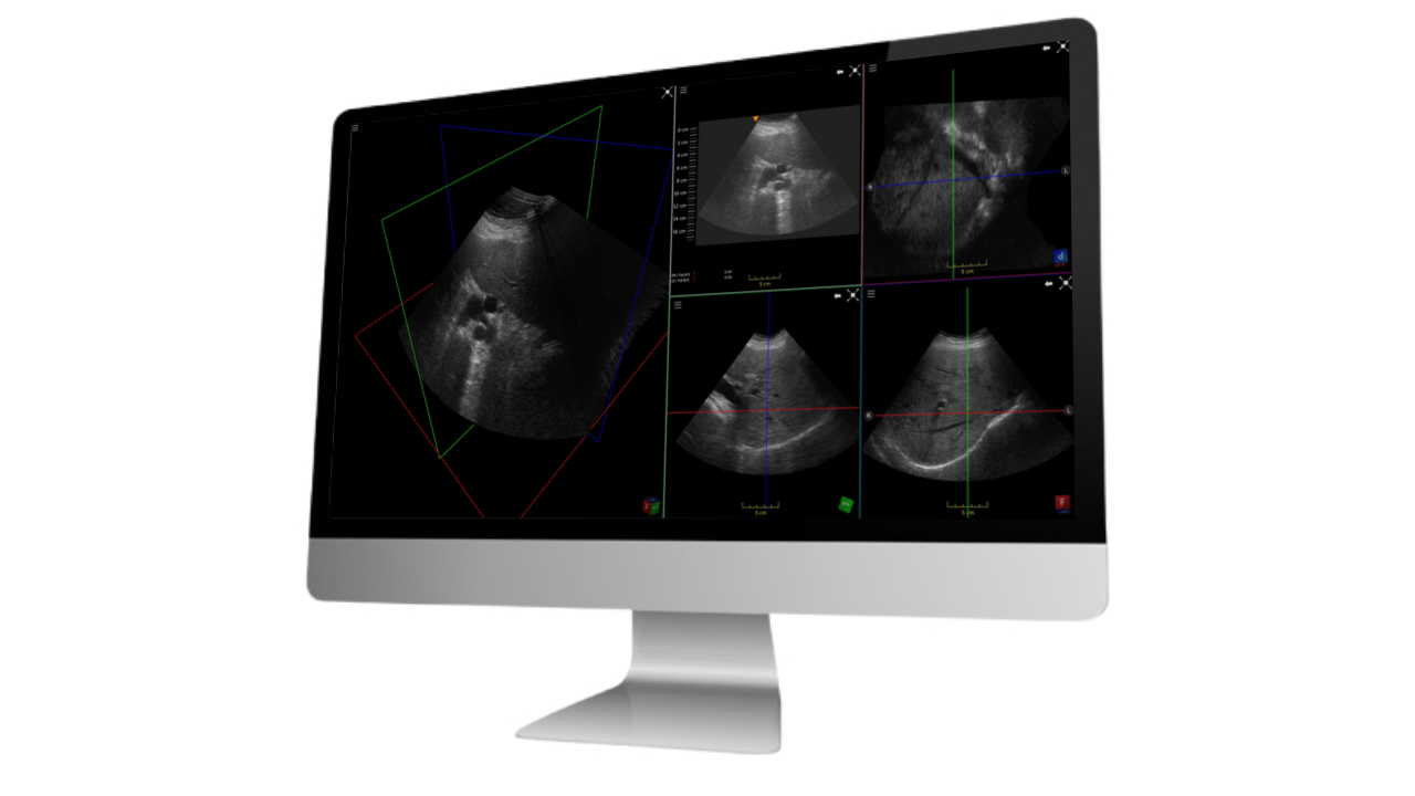Ultrasound - ImFusion
